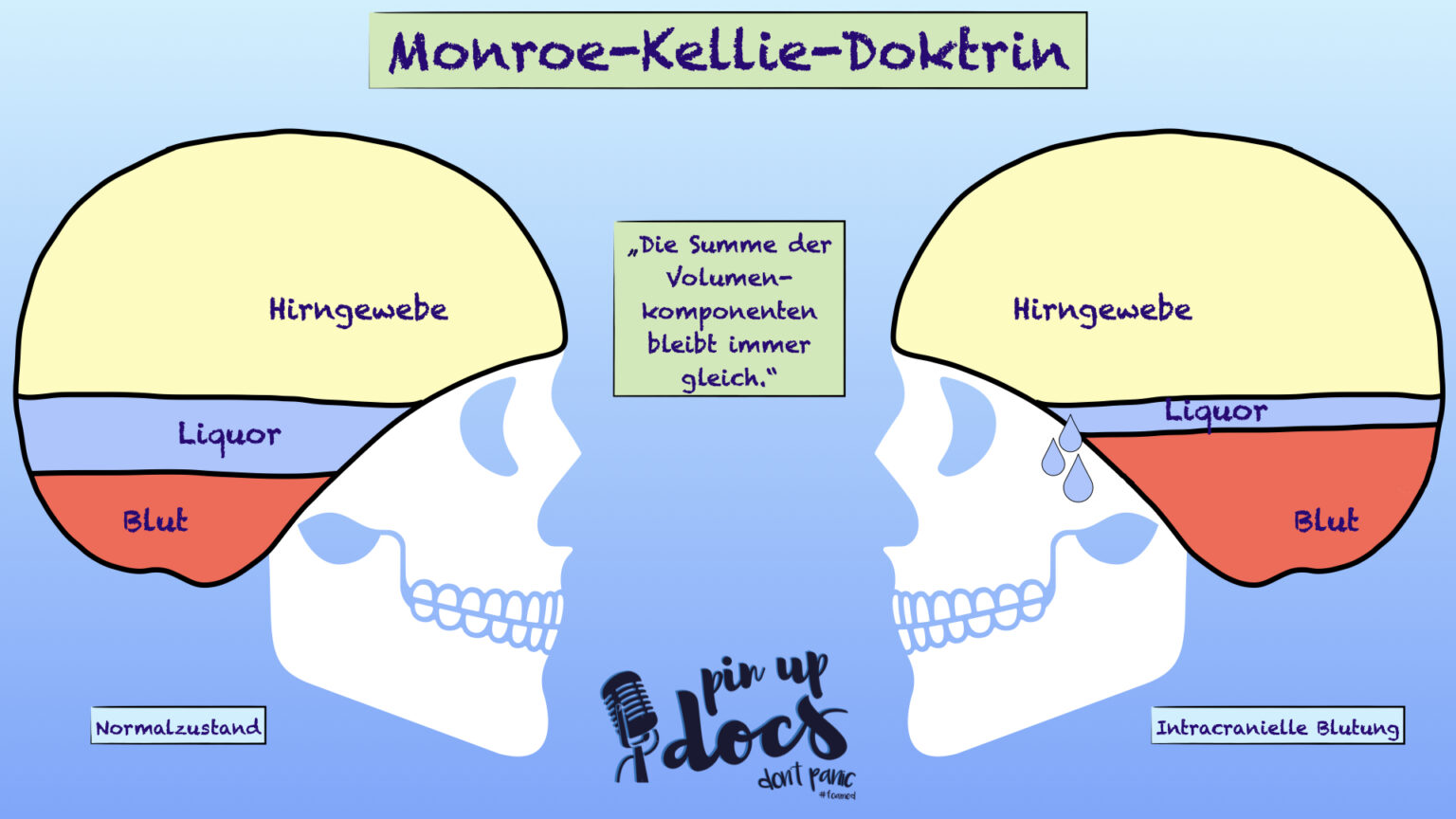 Postpunktioneller Kopfschmerz - PDPH (post dural puncture headache ...