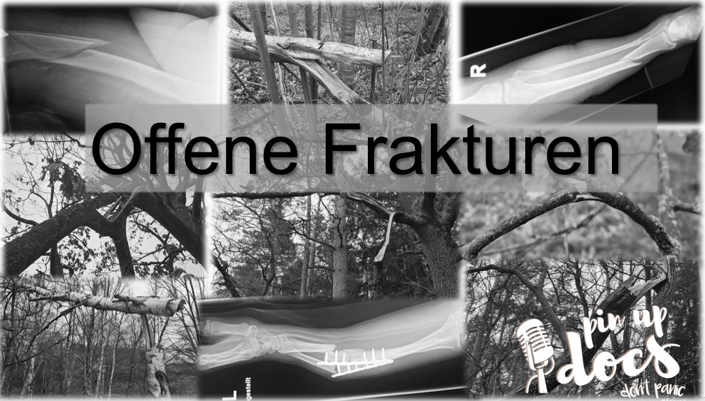 Offene Frakturen – Wenn Knochen aus der Haut fahren... - pin-up-docs ...